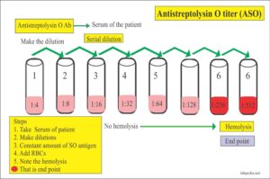 Chapter 25: Autoimmune diseases - Rheumatic Fever - Labpedia.net