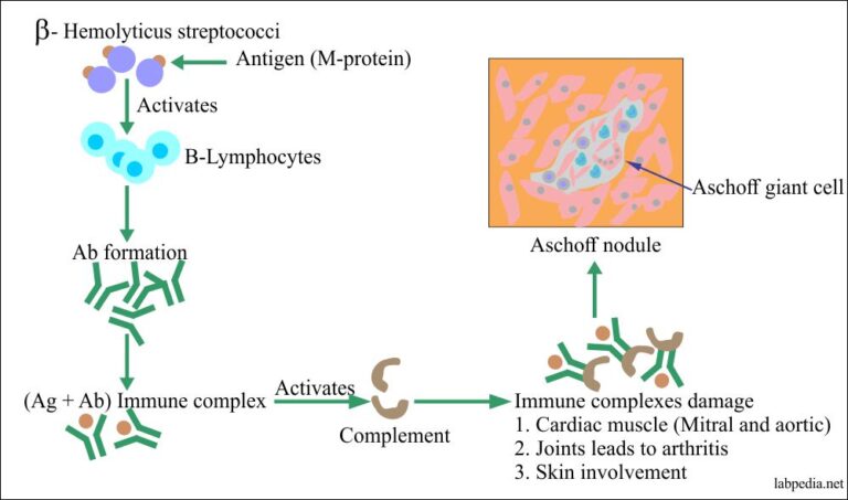 Chapter 25: Autoimmune diseases - Rheumatic Fever - Labpedia.net