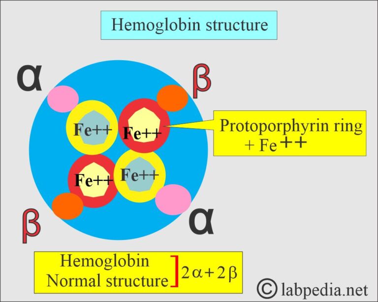 Anemia:- Part 5 A - Sickle Cell Anemia, Discussion and Workup ...