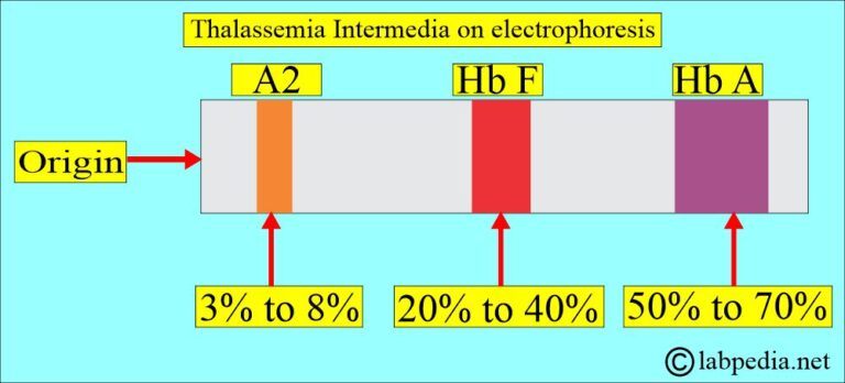 Anemia:- Part 4 - Thalassemia, α-thalassemia and β-thalassemia, Workup ...