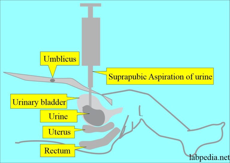 Urine Samples Type, and Composition - Labpedia.net