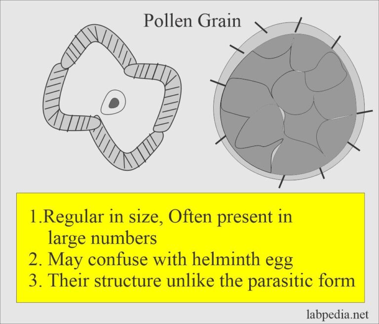 Stool Examination:- Part 1 - Stool Examination and Interpretations ...