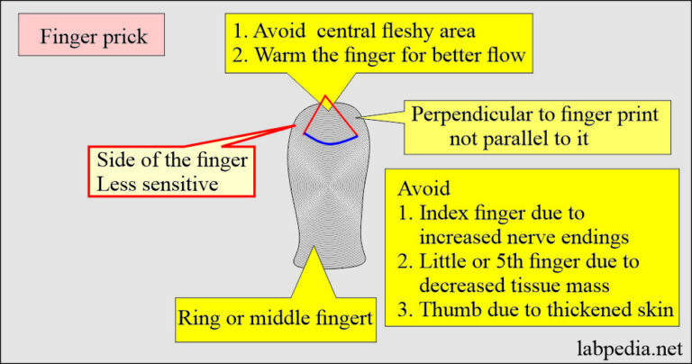 Types of Blood Samples, Criteria for rejection of the blood sample ...