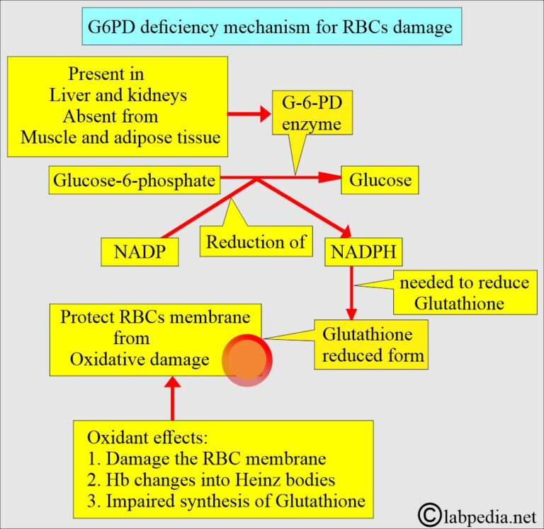Anemia:- Part 10 - Glucose-6-Phosphate Dehydrogenase Deficiency (G6PD ...