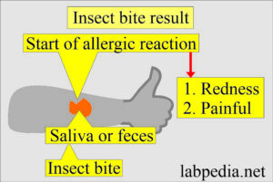 Insect Bites - Labpedia.net